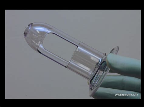 Minimising Complications Ppt Download