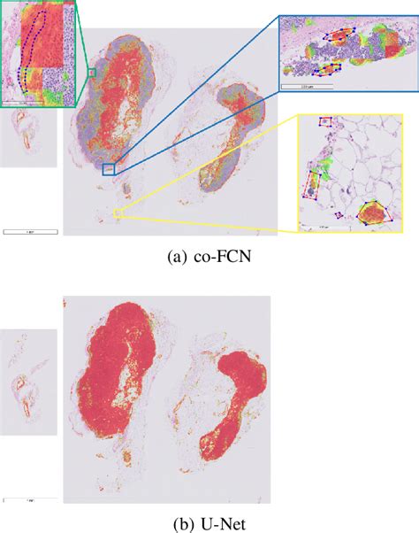 Figure 5 From Conditional Deep Convolutional Neural Networks For