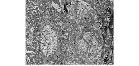 Survey Electron Micrographs At The Same Magnification Showing Two Survey Electron Micrographs At The Same Magnification Showing Two