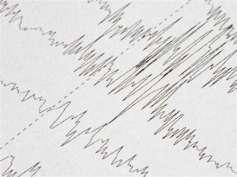 EEG Electroencephalogram Purpose Procedure And Risks