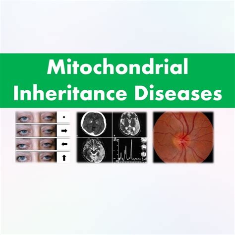Examples Of Mitochondrial Inheritance Diseases Rish Academy