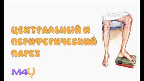 Центральный и периферический паралич Youtube