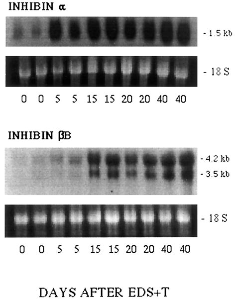 Representative Northern Blot Analyses Of Testicular Inhibinand Download Scientific Diagram