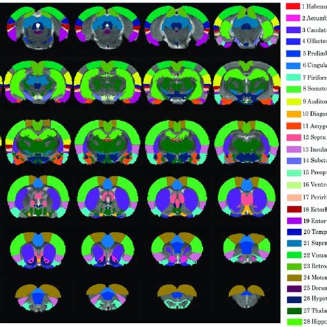 Illustration Of The Selected Brain Regions In The Structure Of The Download Scientific