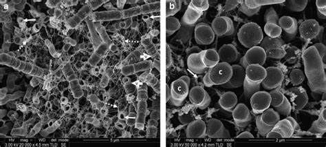 Scanning Electron Micrographs Of Subgingival Dental Plaque A