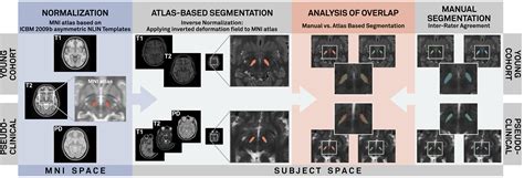 Toward Optimized Nonlinear Deformation Algorithms For Subcortical Dbs Target Regions In Mri