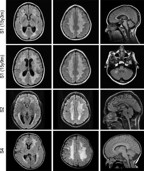 Ct Scan Vs Mri Whats The Difference Difference 101