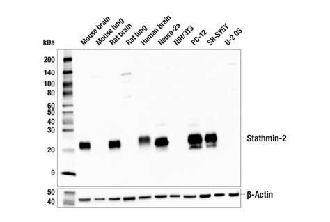 Stathmin 2 E1d2m Rabbit Mab Cell Signaling Technology