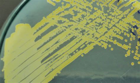 Micrococcus Species