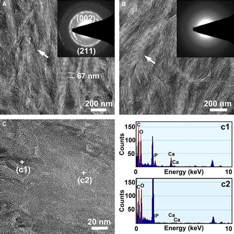 Tem Analysis Of The Native Apatite In Bone Tissue Tem Micrographs A