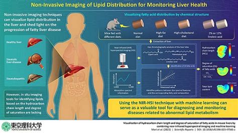 Machine Learning Hones Ability To Image Liver Disease Bioscan Mar Apr 2024 Photonics Spectra