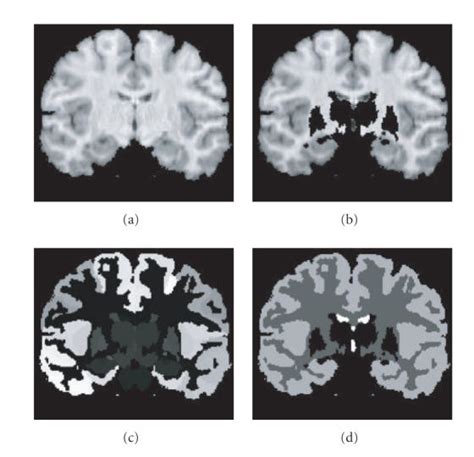 Mri Brain Data A Original Slice With Cortical Structures B