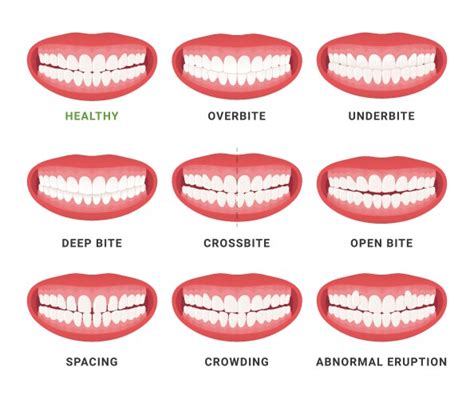 Bite Vector Images Over 35000