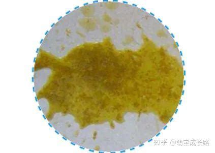 泡沫便、粘液便、绿便宝宝各种性状及颜色的便便这里都有! 知乎 泡沫便、粘液便、绿便宝宝各种性状及颜色的便便这里都有! 知乎