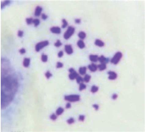 Metaphase Chromosomal Aberrations In Bone Marrow Cells Showing The Download Scientific Diagram