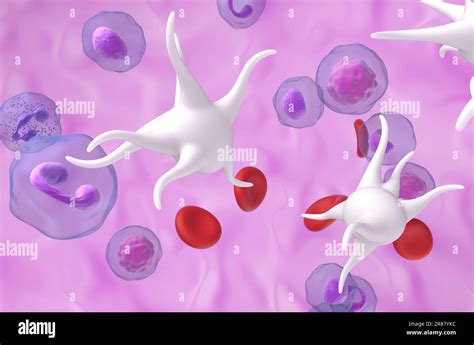 Essential Thrombocythemia Et A Blood Cancer By The Overproduction Of