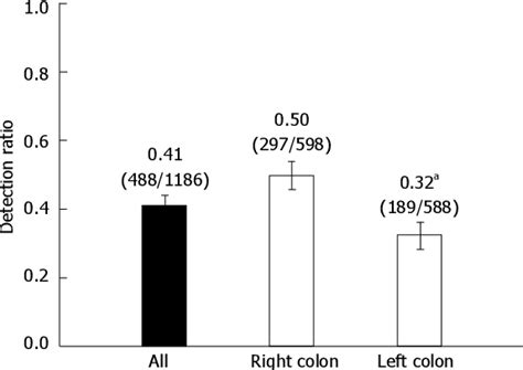 Figure 2 From Colonoscopy Can Miss Diverticula Of The Left Colon