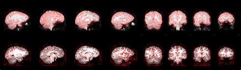 Mri Preprocessing Using Fsl This Tutorial Should Help You To Work By Ninad Aithal Medium Mri Preprocessing Using Fsl This Tutorial Should Help You To Work By Ninad Aithal Medium