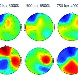 EEG Topographical Representation For 60 Min Download Scientific Diagram