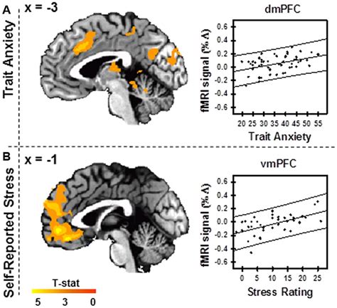 Prefrontal Cortex Activity Is Associated With Biobehavioral Components Of The Stress Response Pmc