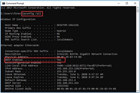 Static Vs Dynamic Ip What Are The Differences And How To Check