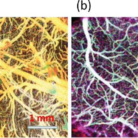 Microvascular Mapping For A A Rat Cerebral Cortex And B A Mouse