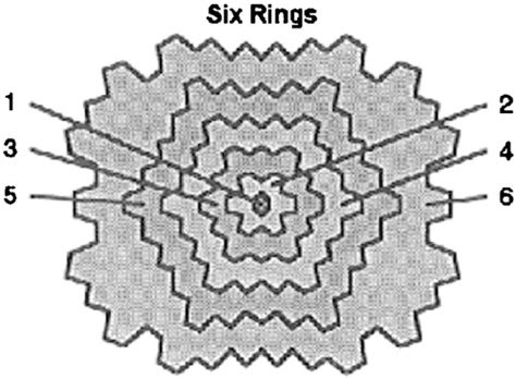 Effects Of Different Degrees Of Cataract On The Multifocal