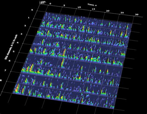 Github Nerviummatlab Gui For Eeg Eeg Feature Visualization On Matlab