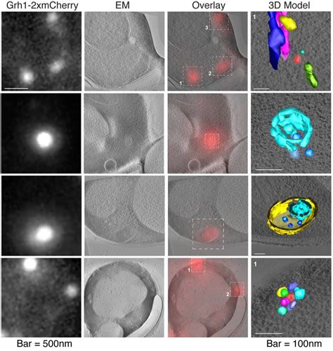 Correlative Light And Electron Microscopy Clem Electron Microscopy Core Facility