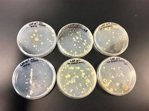 Lab 5 Enumeration Of Microorganisms