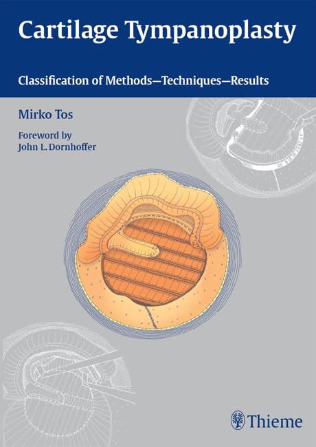 Cartilage Tympanoplasty Classification Of Methods Techniques Results Pdf Epub Version