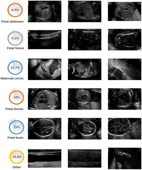 Sample From Classes In The Dataset For Materno Fetal Organ Download Scientific Diagram