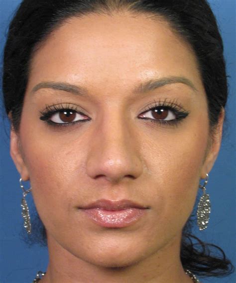 What Does A Persian Nose Look Like