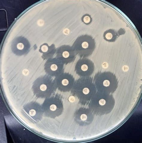 Dr Bahaa Seada On Linkedin Esbl Confirmation Test Ghost And Key Hole Phenomena