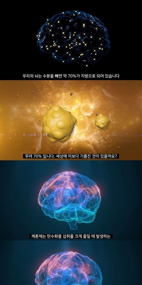 죽어가는 뇌를 살리는 방법 웃음 건강