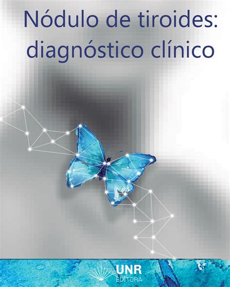 Nódulo De Tiroides Diagnóstico Clínico • Editora Unr