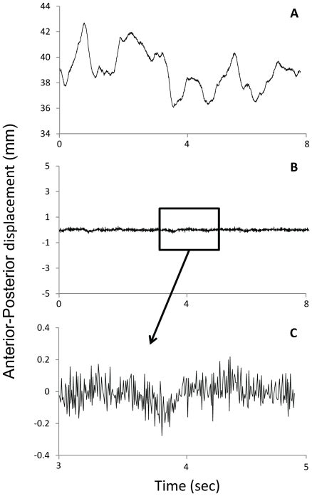 Example Plot Of The Original Center Of Pressure Cop Time Series From Download Scientific