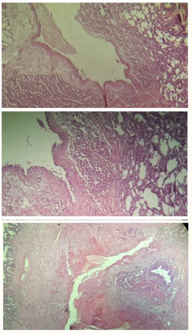Acta Scientific International Open Library Open Access Journals