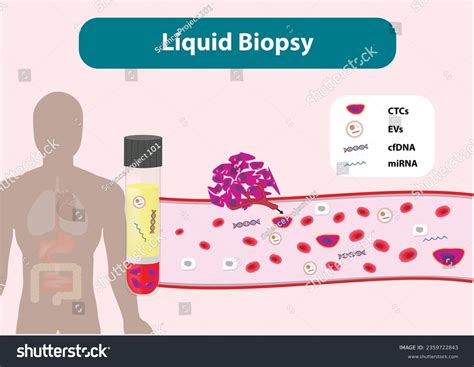 1 Mastitis Detection Stock Vectors And Vector Art Shutterstock