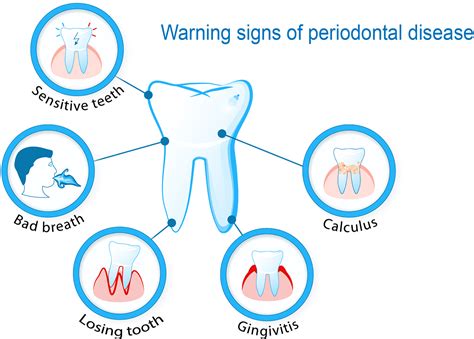 Warning Signs Of Periodontal Gum Disease Complete Smile Dental