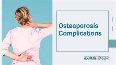 Osteoporosis Complications [causses Symptoms Treatment And Prevention]