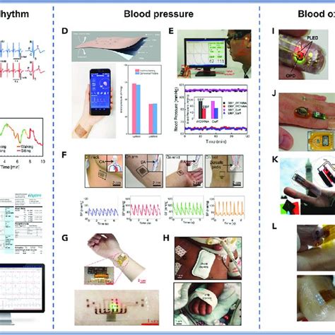 Wearable Sensor Detection Of Cvds A Ecg Detection Using Dry Download Scientific Diagram