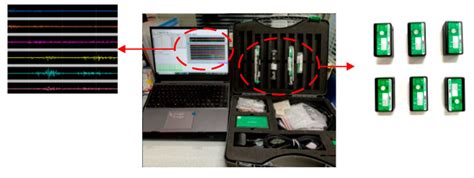Evaluation Of Feature Extraction And Classification For Lower Limb Motion Based On Semg Signal Pmc