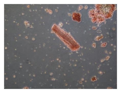 Light Microscopy Photographs Of Congo Red Stained A Herbal