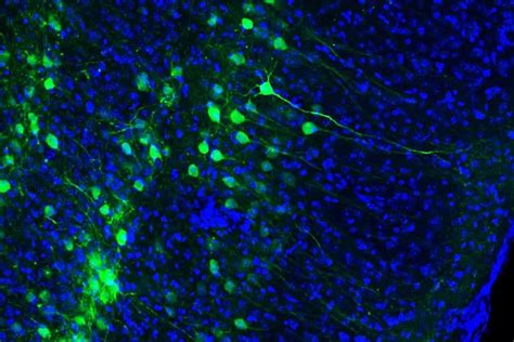 Mit Neuroscientists Build Case For New Theory Of Memory Formation Mit