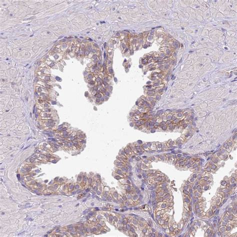 Rabbit Polyclonal Anti Nphp1 Antibody Buy For Research Highly Specific Rigorously Validated