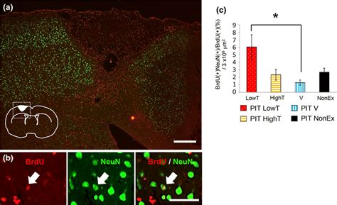 Effect Of Different Exercises On Number Of Brdu Neun ‐double Download Scientific Diagram