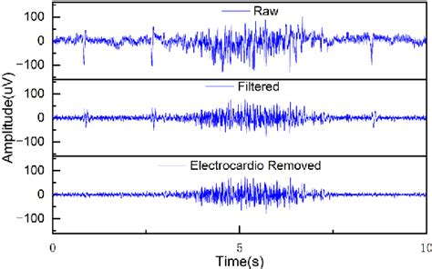 Figure 2 From Using Flexible And Stretchable Surface Electromyography