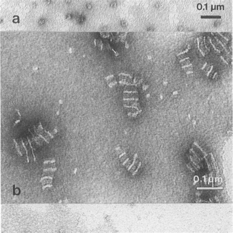 Electron Micrographs Showing Negative Stained Preparations Of A