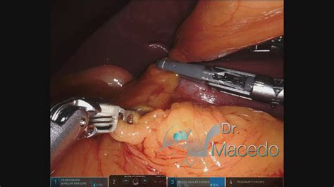 Clinical Robotic Surgery Association